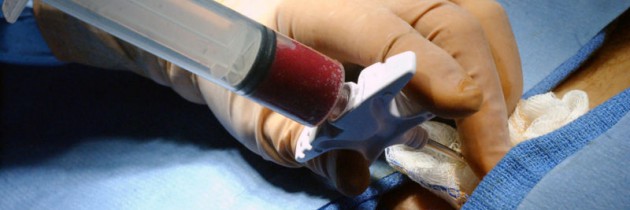Bone Marrow Biopsy Procedure with Video New Health Advisor Bone Marrow Biopsy Procedure with Video New Health Advisor