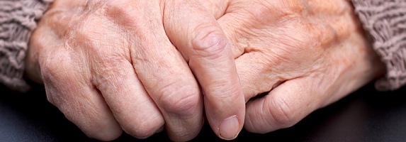 What Is Rheumatoid Arthritis Remission New Health Advisor 9360