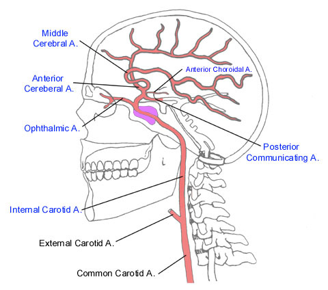 Anterior Choroidal Artery | New Health Advisor