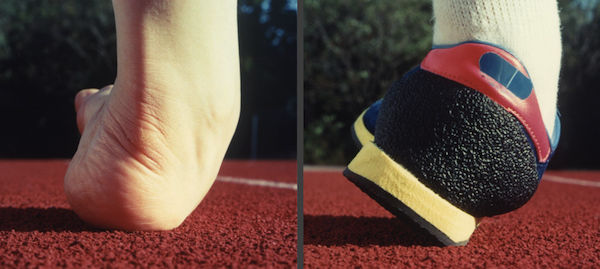 Inversion Ankle Sprains | New Health Advisor