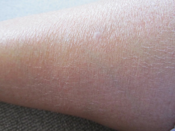 Why Is My Skin So Dry? | New Health Advisor