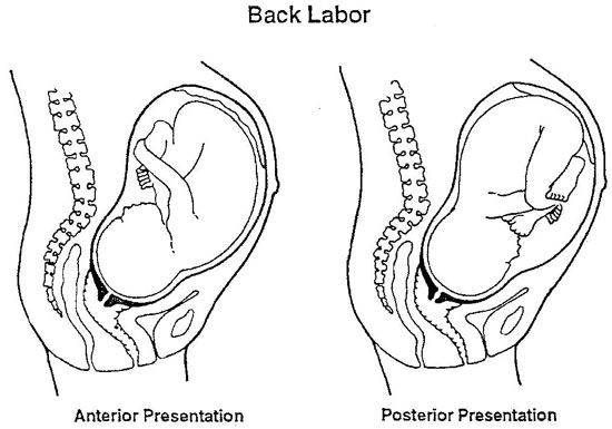 What Does Back Labor Feel Like? | New Health Advisor