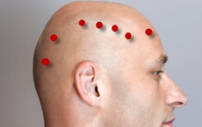 7 Main Pressure Points on Head | New Health Advisor