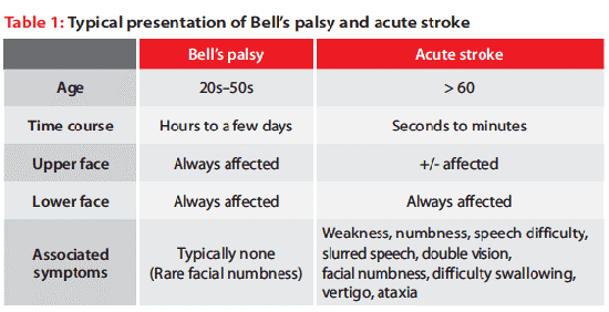Bell's Palsy vs. Stroke | New Health Advisor