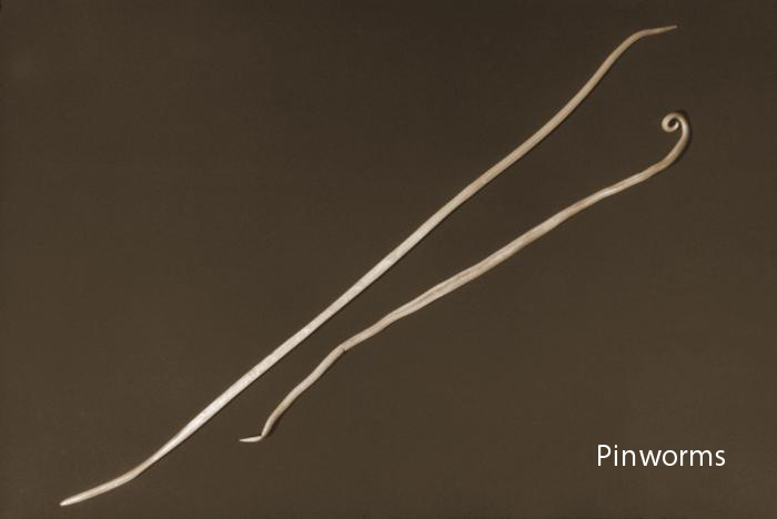 Worms in Human Types and Pictures | New Health Advisor