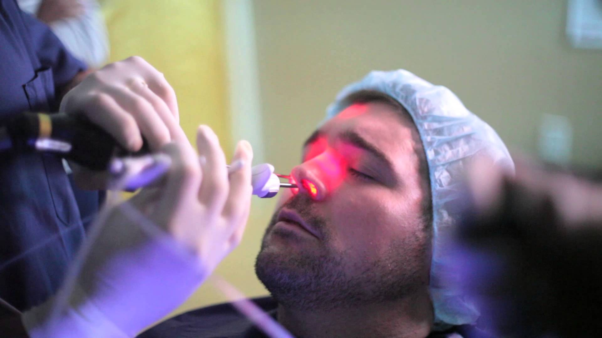 Balloon Sinuplasty Recovery | New Health Advisor