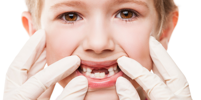 6 Year Molars | New Health Advisor