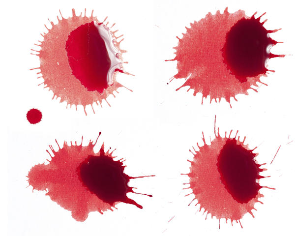 9 Causes of Spotting After Your Period | New Health Advisor