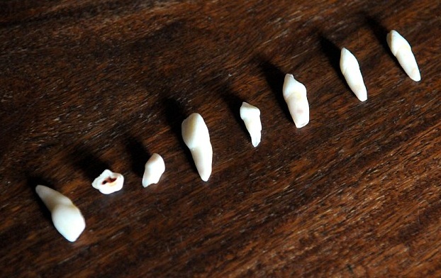 Dream Interpretation: Teeth Falling Out | New Health Advisor