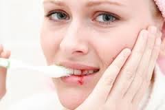 Gums Bleed When Brushing | New Health Advisor