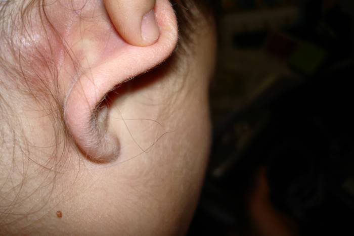 Painful Lump Behind Ear | New Health Advisor