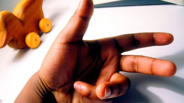 What Causes Numbness in the Left Hand? | New Health Advisor