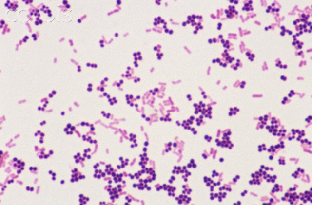 Gram Staining Procedure | New Health Advisor