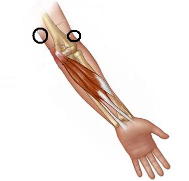 Can't Straighten Arm | New Health Advisor