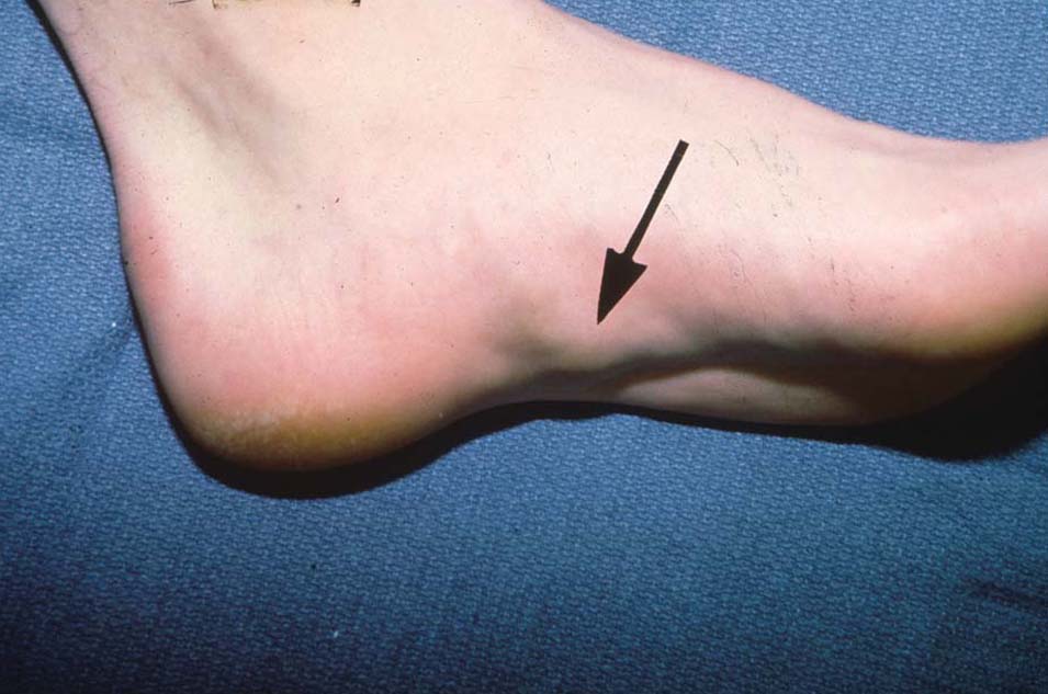 5 Major Foot Bumps and How to Deal with Them | New Health Advisor