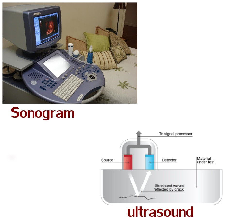 Ultrasound vs. Sonogram | New Health Advisor