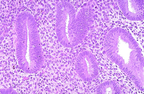 What Is Proliferative Phase Endometrium and Secretory Endometrium ...