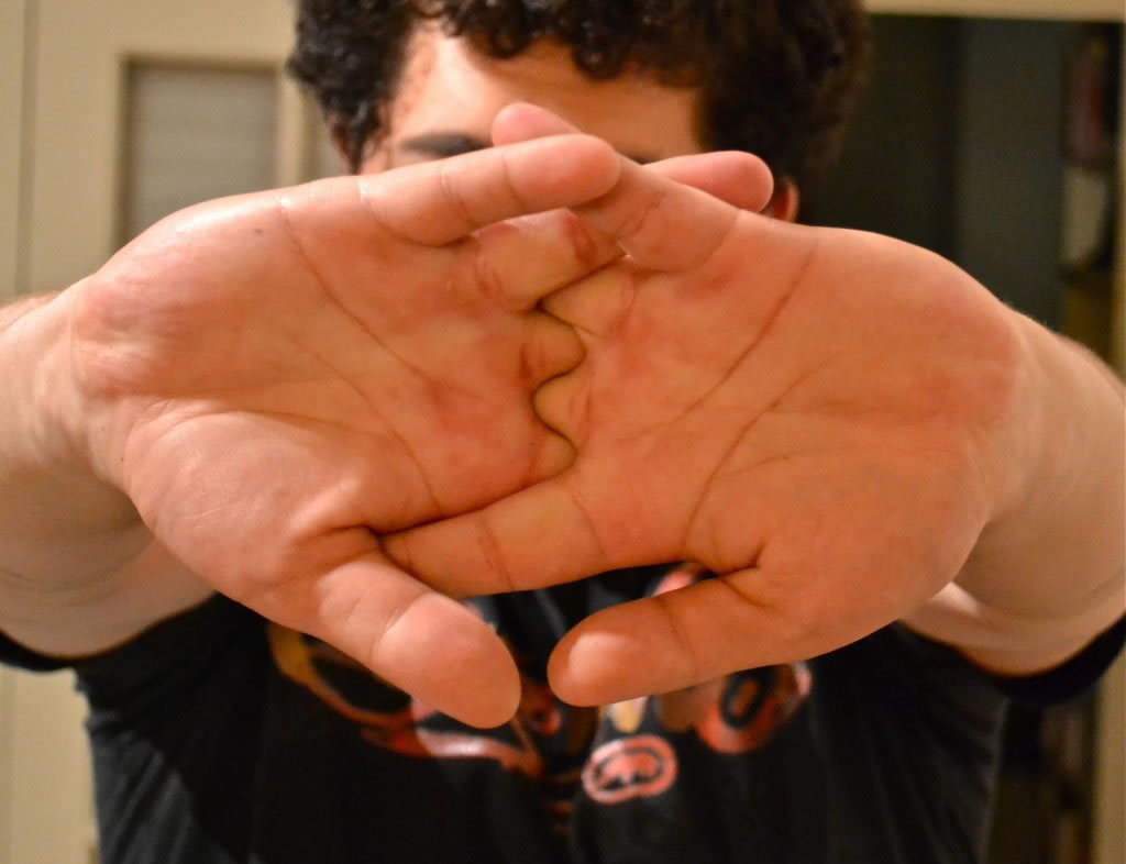 Does Cracking Your Knuckles Cause Arthritis? | New Health Advisor