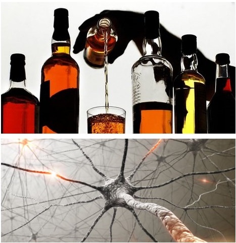 Does Alcohol Kill Brain Cells? | New Health Advisor