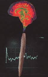 How Does Marijuana Affect the Brain? | New Health Advisor