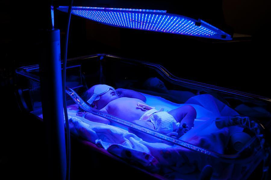 Phototherapy for Jaundice | New Health Advisor