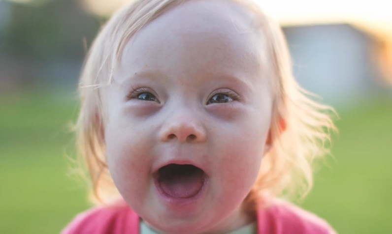 Down Syndrome Risk by Age | New Health Advisor
