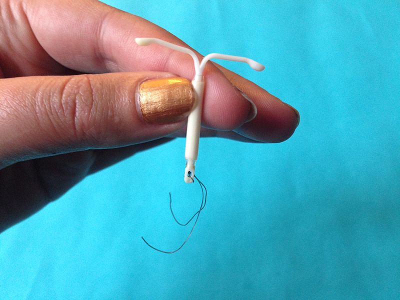 What to Expect After IUD Removal | New Health Advisor