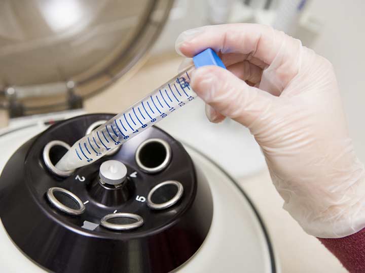 Precautions after Embryo Transfer | New Health Advisor