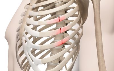 Rib Fracture Healing Time | New Health Advisor