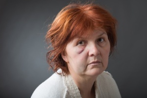 Swollen Face in the Morning: Causes and Treatments | New Health Advisor