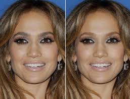 How to Lighten Eyebrows | New Health Advisor